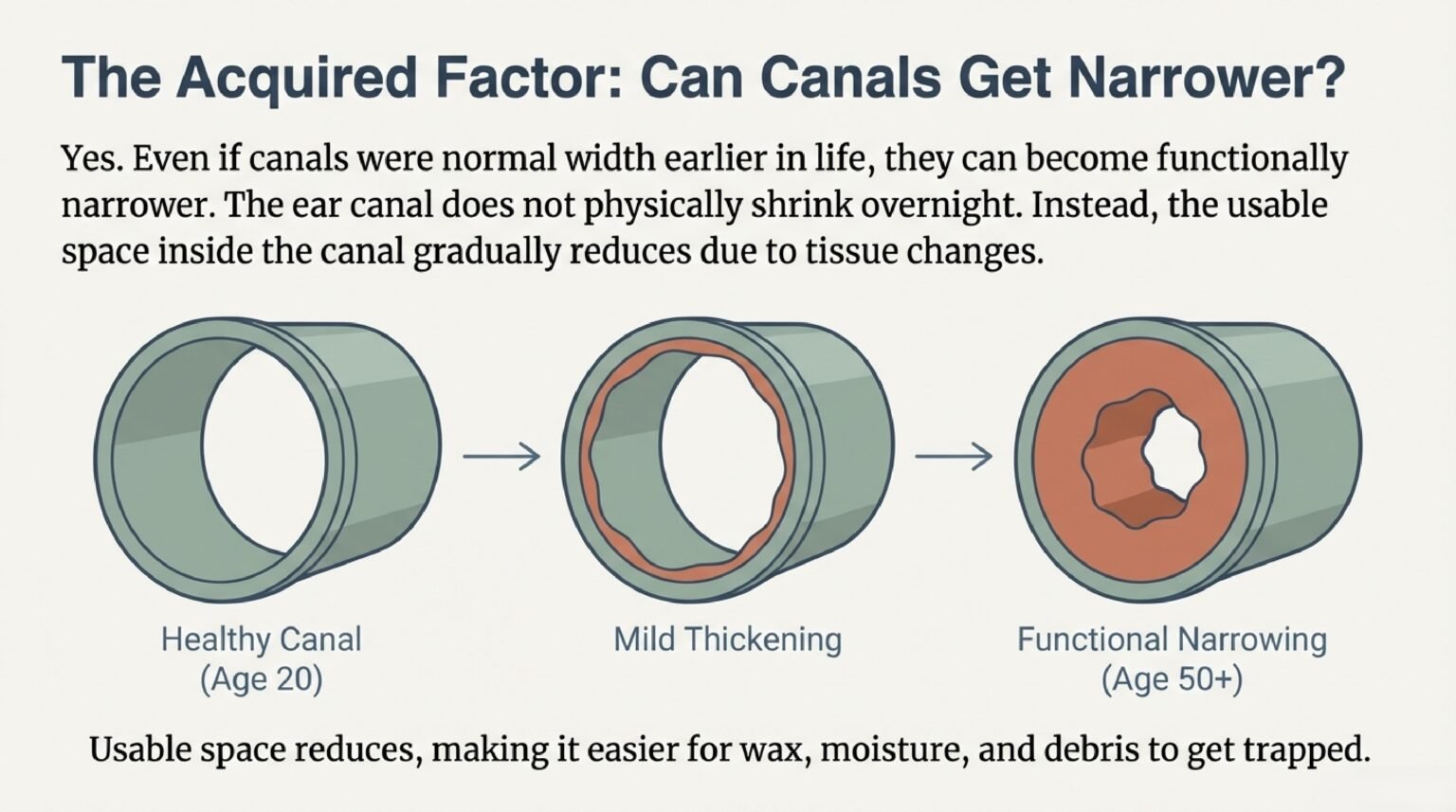 Narrow Ear Canals In Adults: Causes, Risks And Treatment | Dewaxify